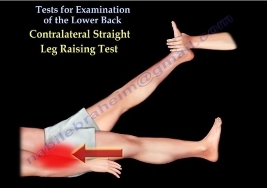 여러가지 요추검진 - SLR test, CSLR test, 패트릭검사, Waddell's sign 등 : 네이버 블로그