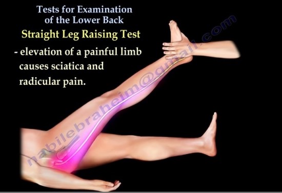 여러가지 요추검진 - SLR test, CSLR test, 패트릭검사, Waddell's sign 등 : 네이버 블로그
