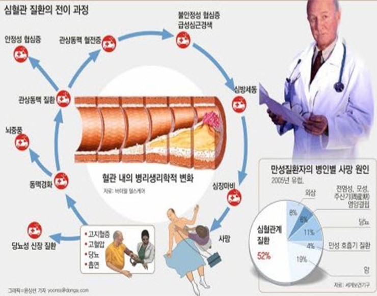 심장질환의 전이과정과 판막질환 네이버 블로그