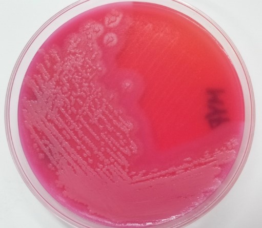 [바실러스 세레우스] Bacillus cereus, MYP배지, 혼탁한 환을 지닌 분홍색 집락 : 네이버 블로그