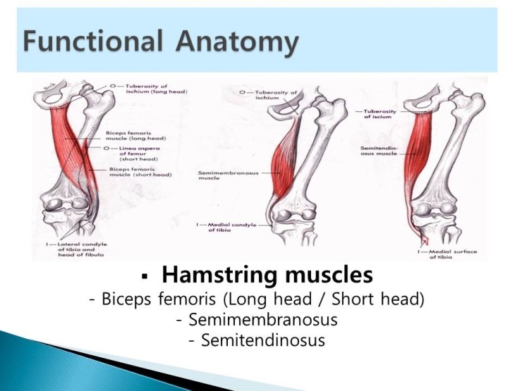 햄스트링 손상hamstring Tear 기전 및 재활운동치료 네이버 블로그