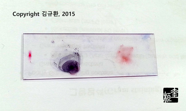 그람 염색 세균을 유용하게 분류하는 방법 현미경 관찰 네이버 블로그