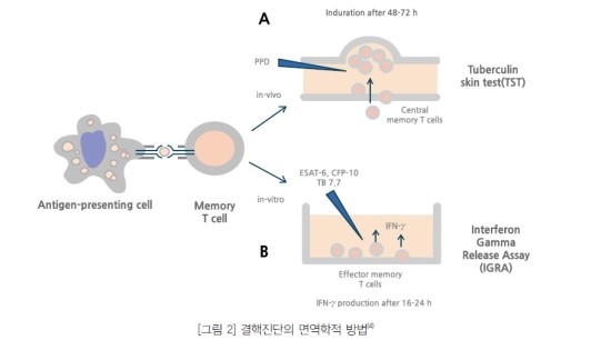 잠복결핵 검사(인터페론감마분비검사IGRA.투베르쿨린 피부반응검사 TST비교 : 네이버 블로그