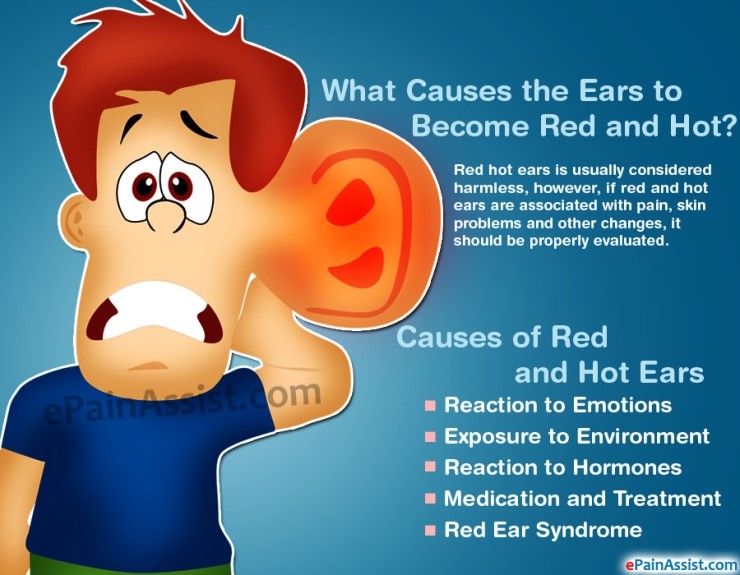 붉은 귀 증후군 - Red ear syndrome : 네이버 블로그