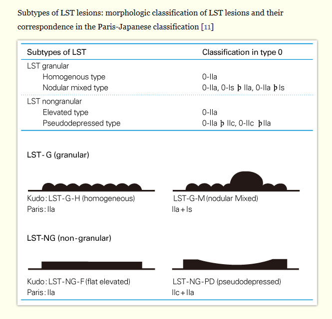 Colon LST classification(Kudo/paris)/pit pattern : 네이버 블로그