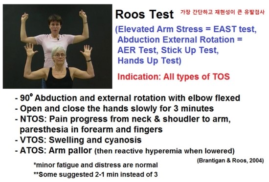 흉곽출구증후군(Thoracic outlet syndrome)의 이학적 검사 : 네이버 블로그
