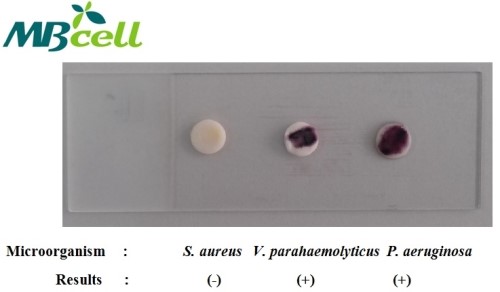 Oxidase 시험 : 네이버 블로그
