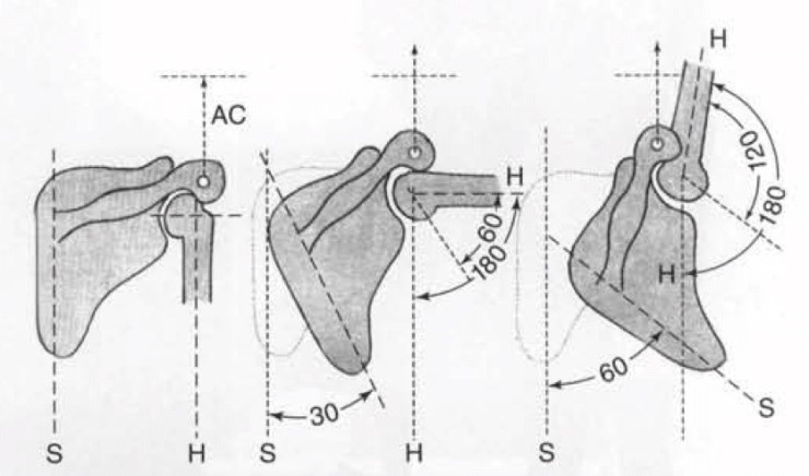 견갑골 하방회전 증후군(scapular downward rotation syndrome) : 네이버 블로그