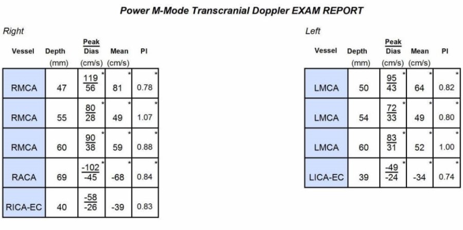 뇌혈류 검사 TCD; transcranial doppler : 네이버 블로그