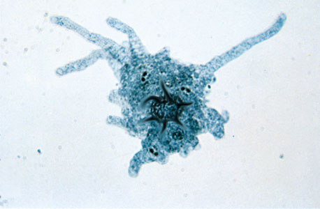 SCP-1121 - 박피병 : 네이버 블로그