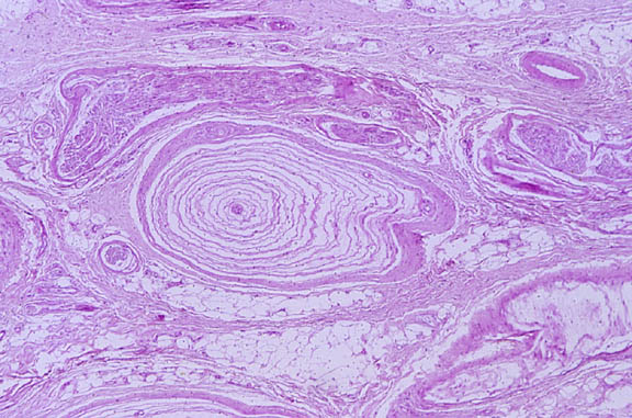 Receptor endings (수용기 종말) 무피막수용기, 자유신경종말, 촉각원반, 털주머니수용기. Meissner's ...