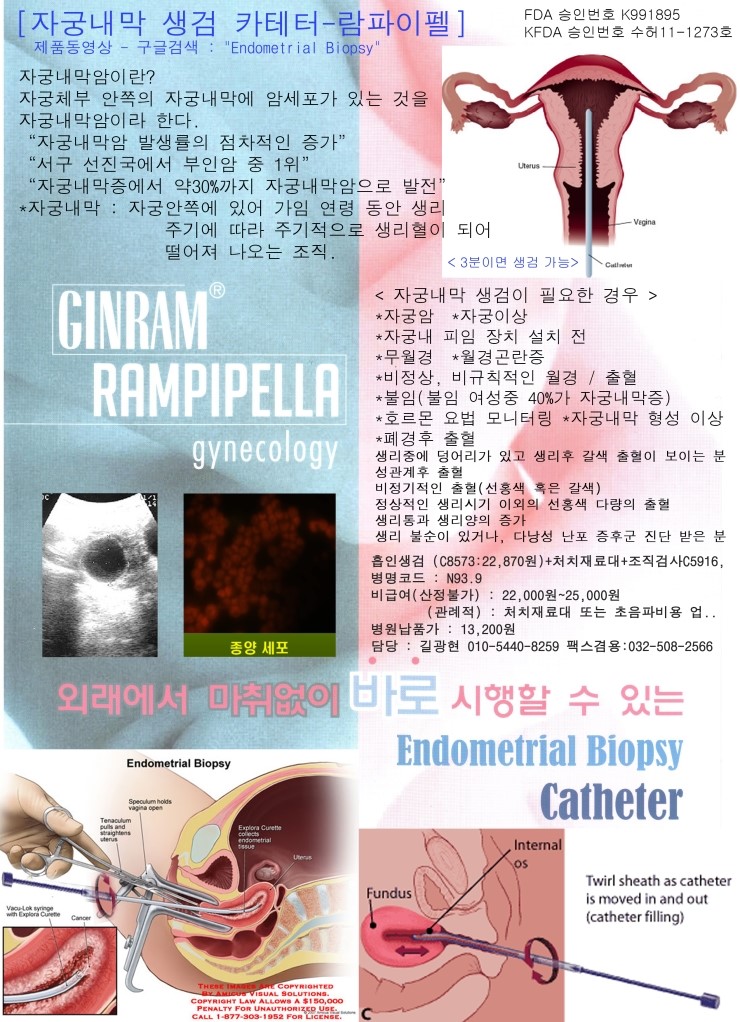 자궁내막생검,endometral biopsy,rampipella,람파이펠,람파이펠라,Pipelle,파이펠라,z-sampler,z ...