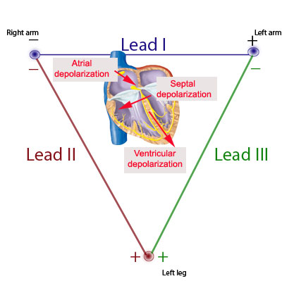 정상 심전도 EKG, 심근경색 부정맥 등 심장 질환 ECG [임상생리학 clinical physiology] : 네이버 블로그