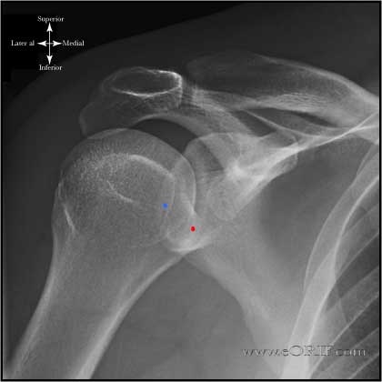Shoulder X-ray의 Anatomy와 Positioning : 네이버 블로그