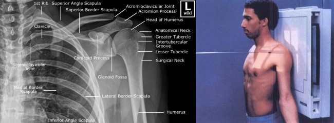 Shoulder X-ray의 Anatomy와 Positioning : 네이버 블로그