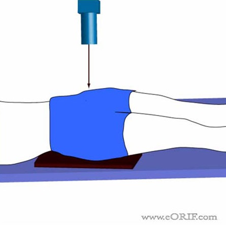 Pelvic X-ray의 Anatomy와 Positioning : 네이버 블로그