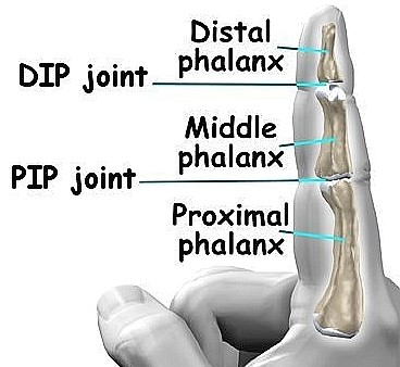 ip joint - dip joint, pip joint : 네이버 블로그