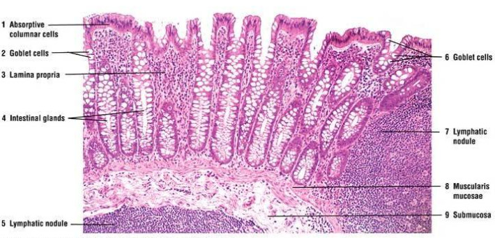 mucosa-associated lymphoid tissue(MALT) lymphoma : 네이버 블로그