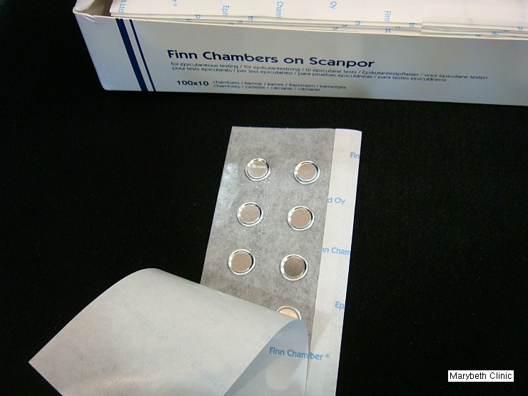 한국에 흔한 피부질환 [개정판] - 제3장 알레르기접촉피부염 - 진단 - (4) 첩포검사(patch test) - A. 첩포검사 ...