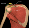 도곡한의원 어깨가 아파요 회전근개증후군과 회전근개파열 회전근개염증 어깨충돌증후군 이란 무엇인가 네이버 블로그