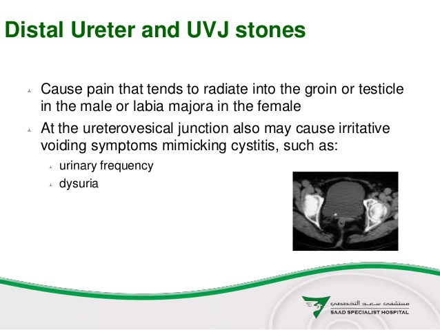 UVJ stone case study : 네이버 블로그