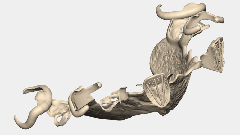 EXOCAD Partial Framework : 네이버 블로그