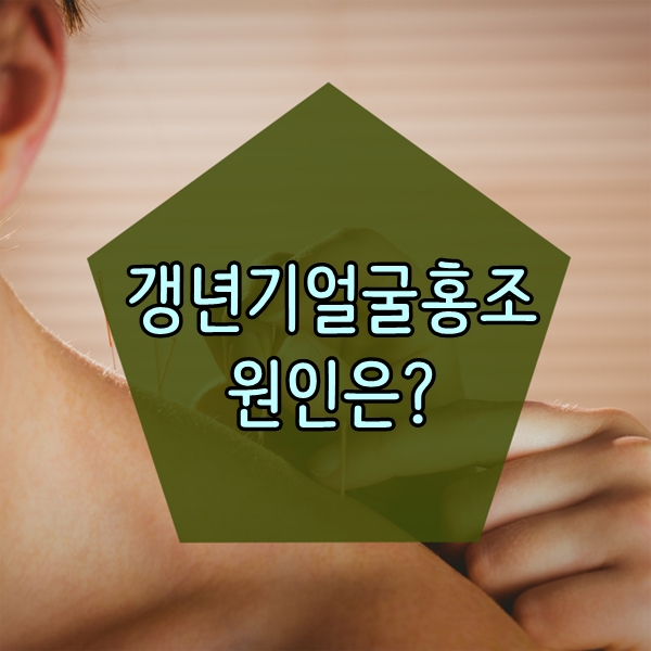갱년기얼굴홍조 원인은 네이버 블로그