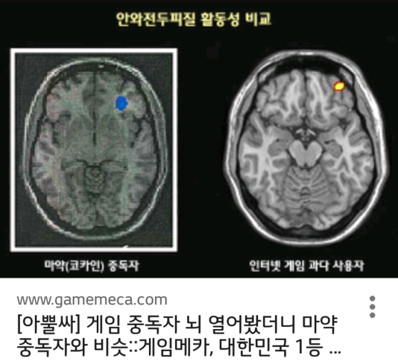 게임중독자의 뇌 네이버 블로그