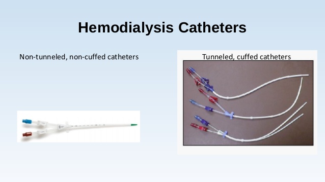 혈액투석 HD(hemodialysis) : 네이버 블로그