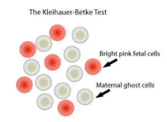 Kleihauer-Betke test : 네이버 블로그