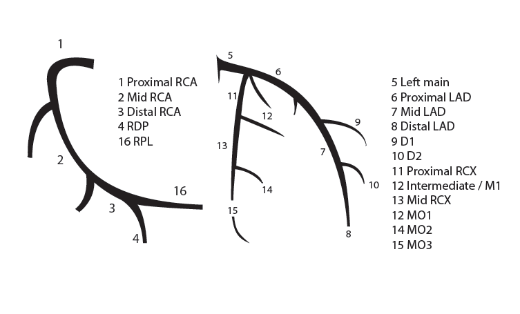 coronary anatomy : 네이버 블로그
