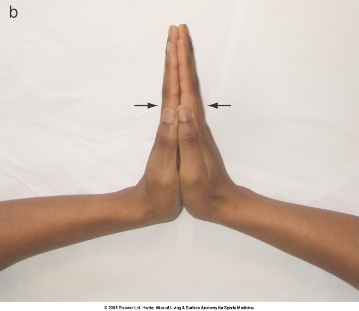 팔렌 테스트 (phalen test) - 수근관증후군(carpal tunnel syndrome) 진단 검사 : 네이버 블로그