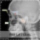PNS Lateral : 네이버 블로그