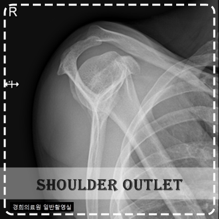 Shoulder outlet view (impingement syndrome) : 네이버 블로그