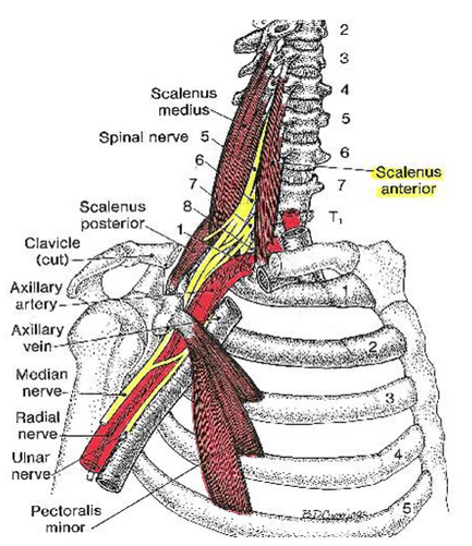 흉곽출구증후군의 원인과 증상 및 치료 Tos Syndrome 네이버 블로그