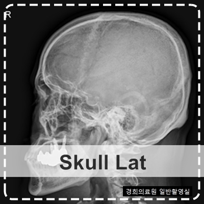 Skull Lateral : 네이버 블로그