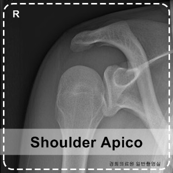 Shoulder apical oblique : 네이버 블로그