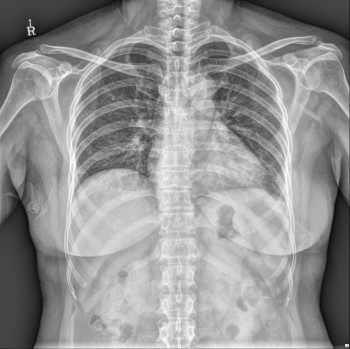 Rib ap : 네이버 블로그