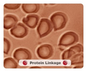 [진단학] 생혈액검사(Live Blood Analysis) : 네이버 블로그