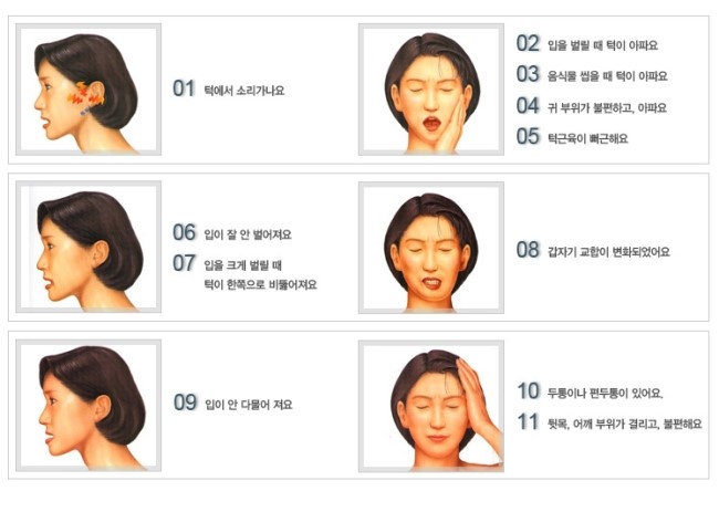턱관절 장애 예방 및 도움이 되는 기본 스트레칭 체조 순천 여수 광양 턱관절 안면비대칭 다우 한의원 네이버 블로그