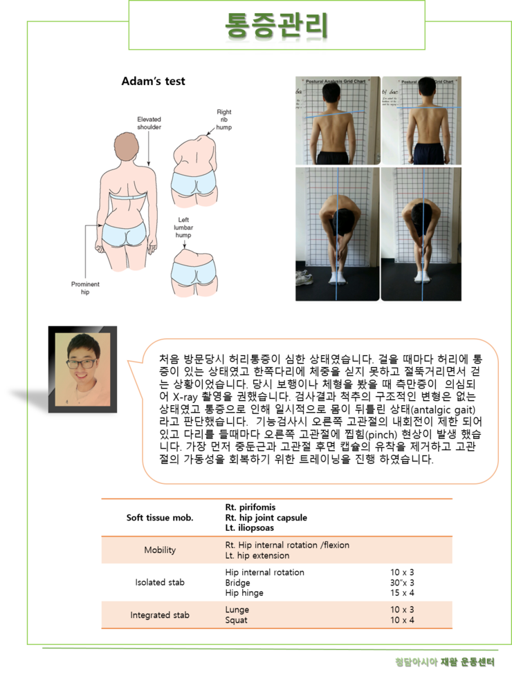 골반 뒤틀림, antalgic posture - hip joint dysfunction : 네이버 블로그