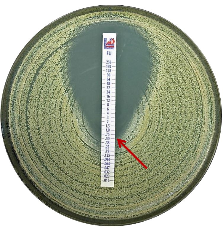 MIC test : 네이버 블로그