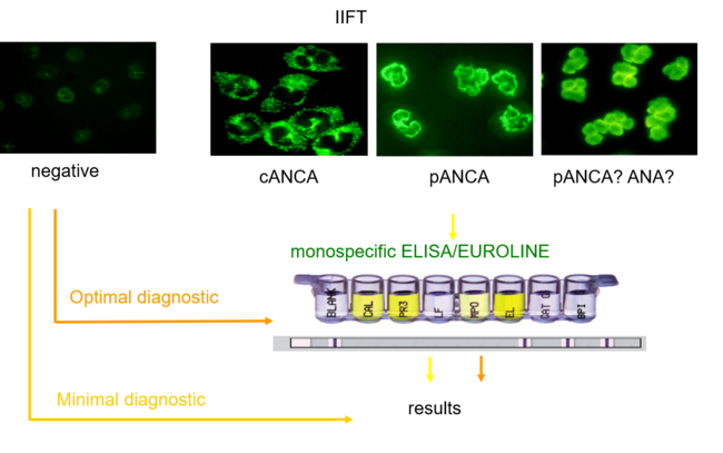 항호중구세포질항체 (ANCA) 임상적 의미 및 추천 제품 : 네이버 블로그