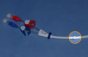 임상) PICC, C-line, Chemoport 차이점, 관리 방법 등 : 네이버 블로그