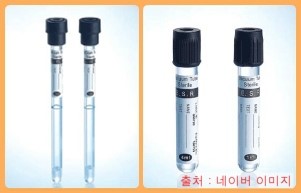 [혈액학검사] ESR(적혈구침강속도) 임상적의의 : 네이버 블로그