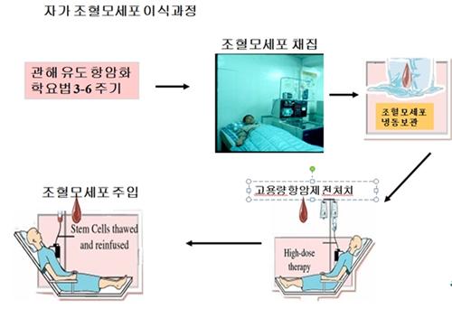 자가조혈모세포이식 네이버 블로그