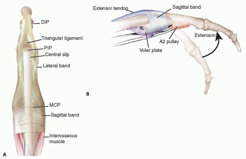 시상대(sagittal band) 손상 : 네이버 블로그
