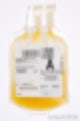 수혈요법(Transfusion, T/F)에 대해서.(정의, 목적, 적응증, 부작용, 간호, 주의사항) : 네이버 블로그