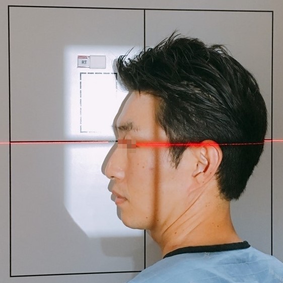 PNS Lateral : 네이버 블로그