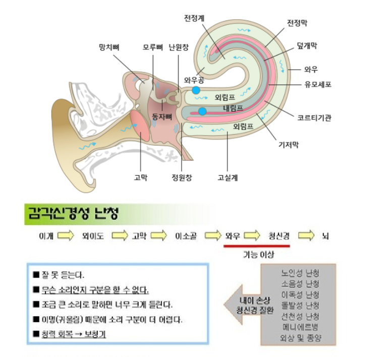 청력손실 Hearing Loss 전음성난청 감각신경성난청노인성난청 소음성난청 이독성약물에의한 난청 혼합성난청